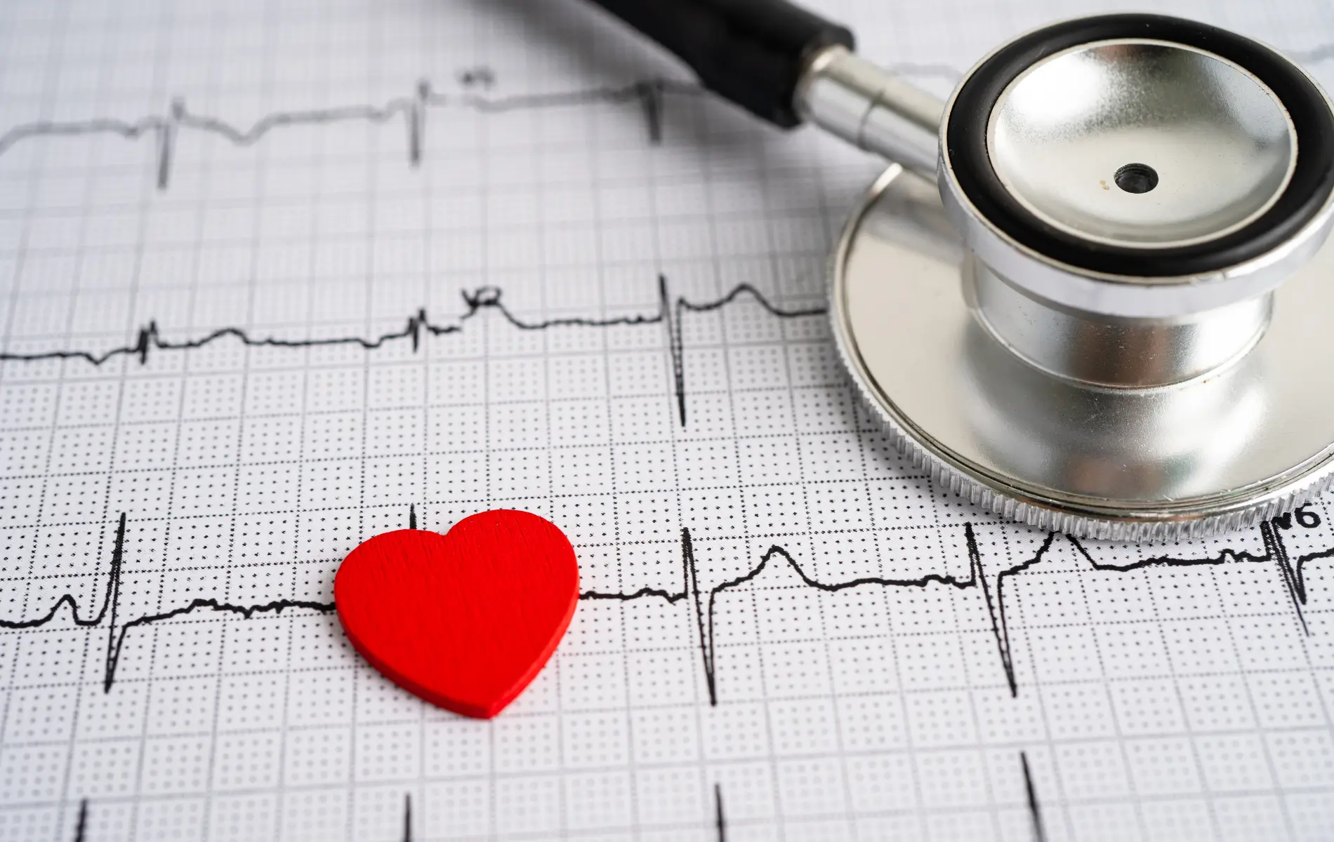 ECG Test in Patna - Dr. Ratan Prakash Clinic